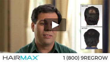 Success Stories | Real Users. Real Results. – Hairmax